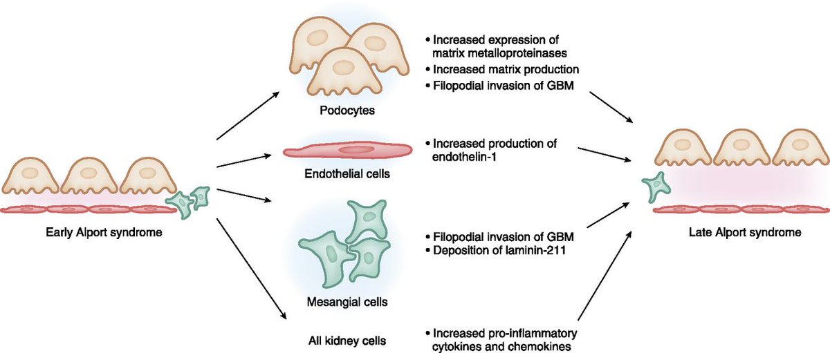 Alport Syndrome Basement Membrane