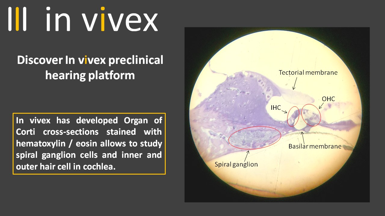 Basilar Membrane Histology