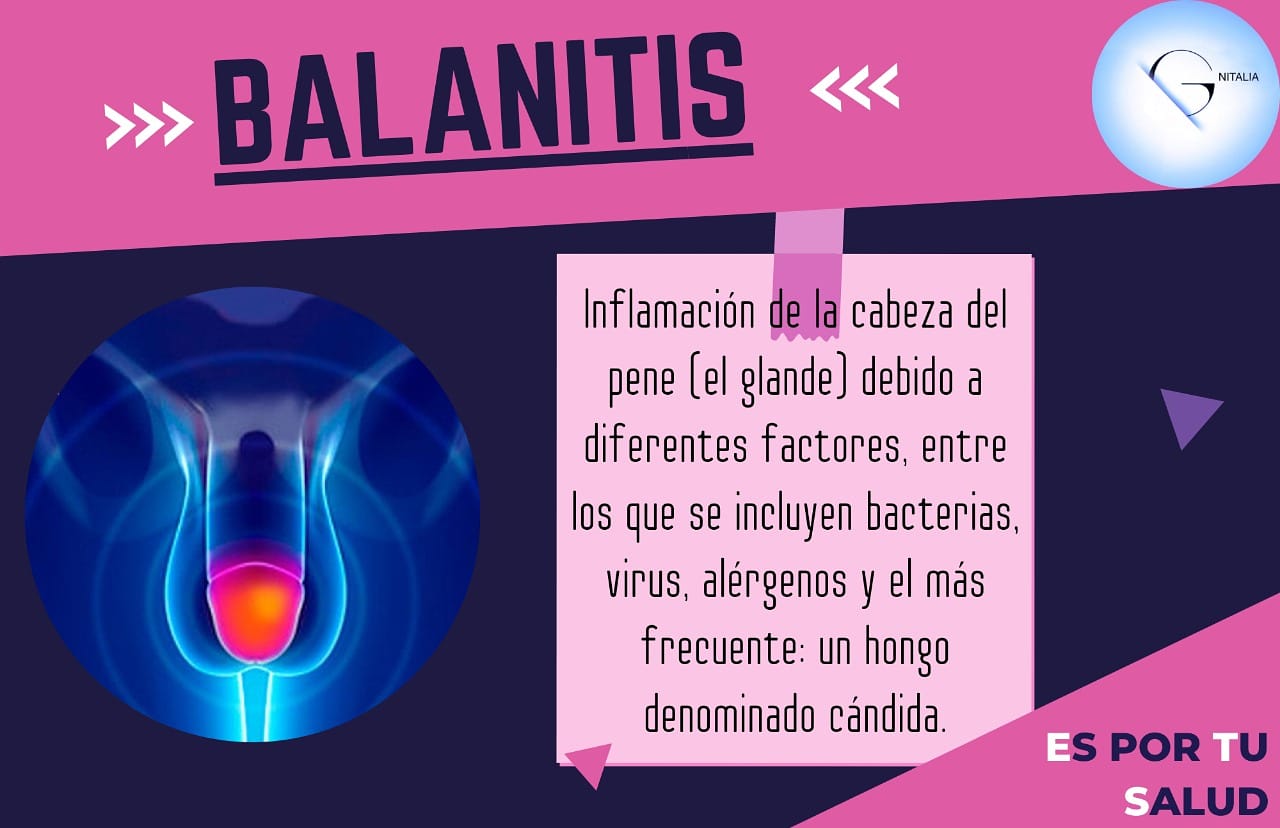 Cabeza conjunto Deslumbrante sintomas balanitis por candida Preguntar ...