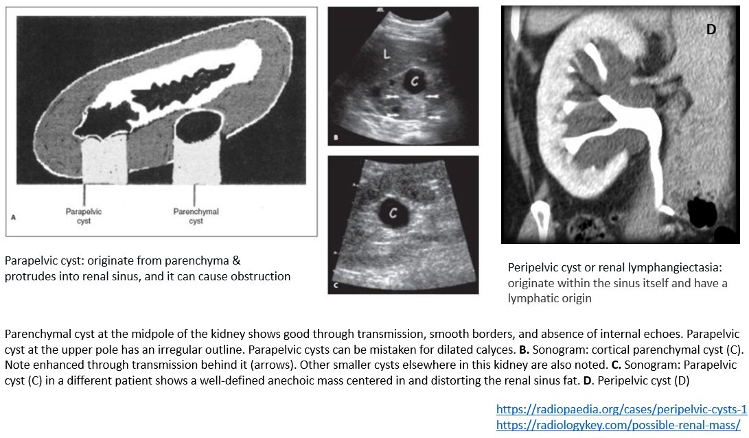 1/ Hello #MedTwitter This month’s @ASPNeph Imaging Webinar was about # ...
