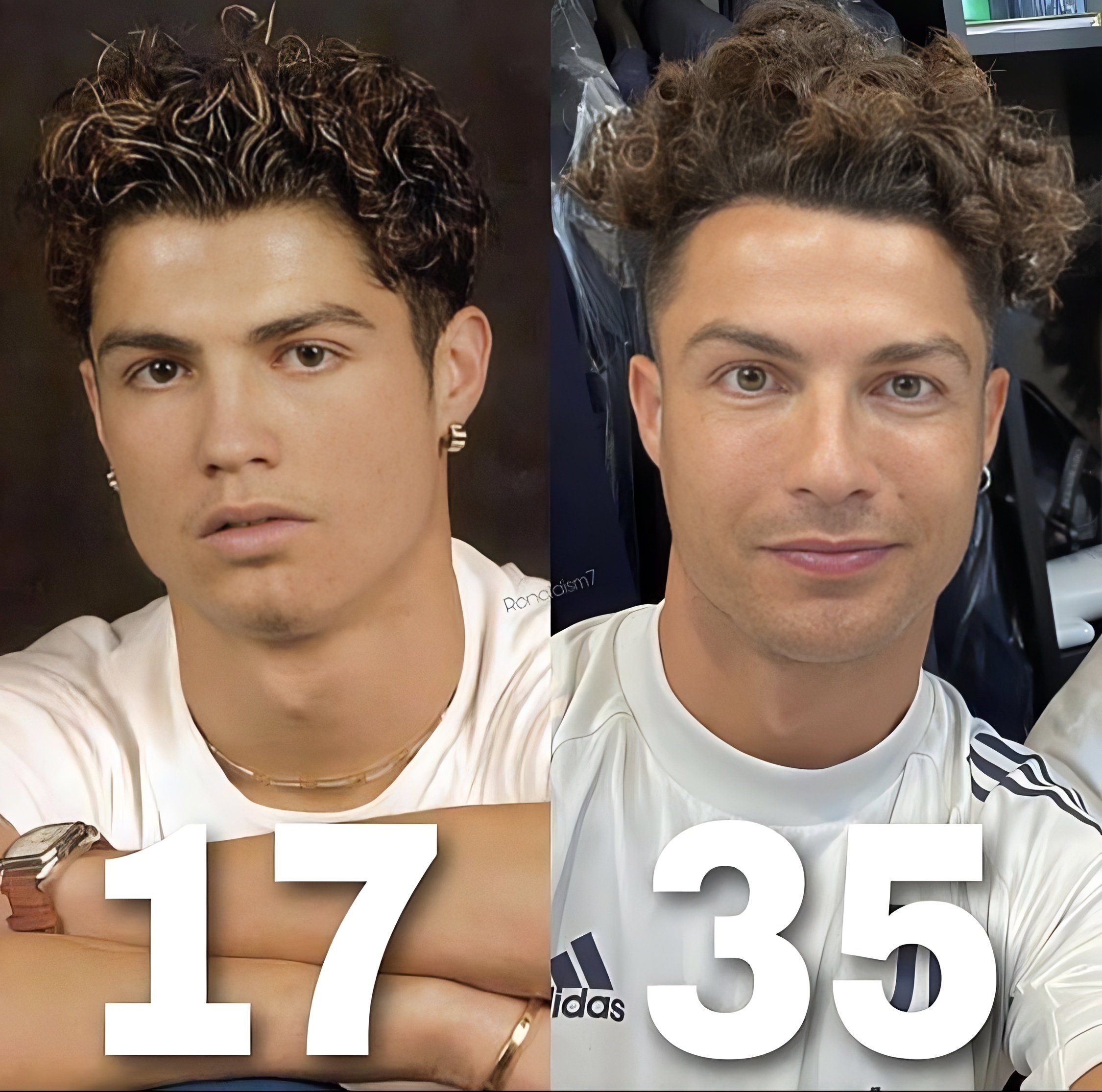 Cristiano Ronaldo Plastic Surgery