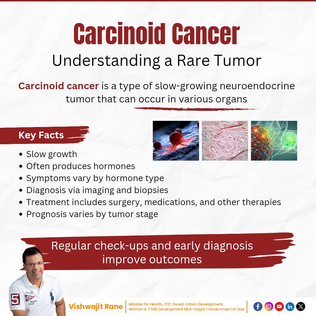 Carcinoid Cancer