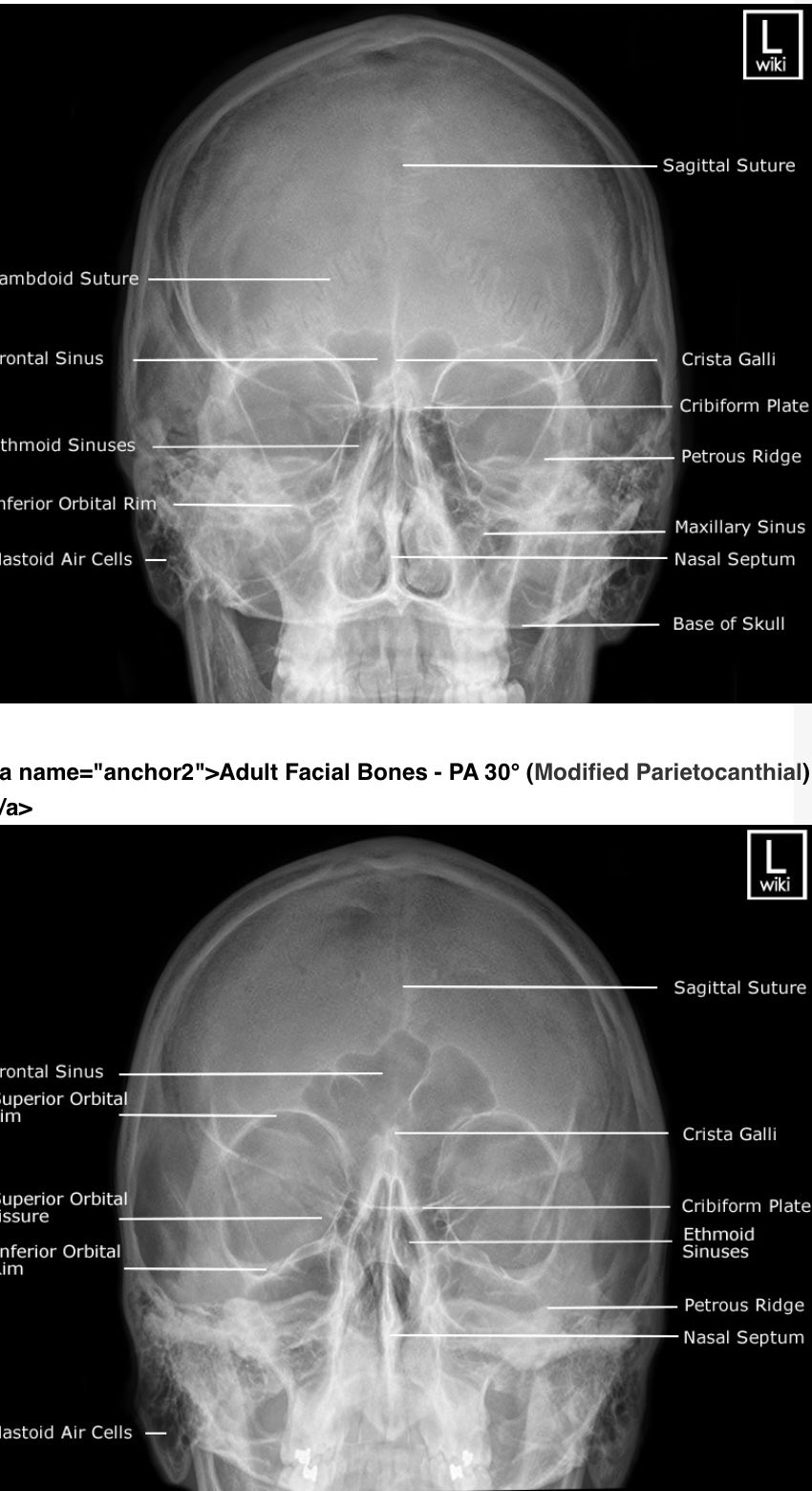 X Ray Of Skull Anatomy Skull | Radiology Key