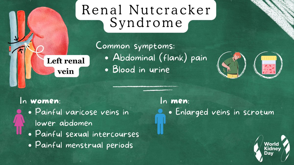 Nutcracker Syndrome Causes Nutcracker Syndrome: How To Diagnose It And