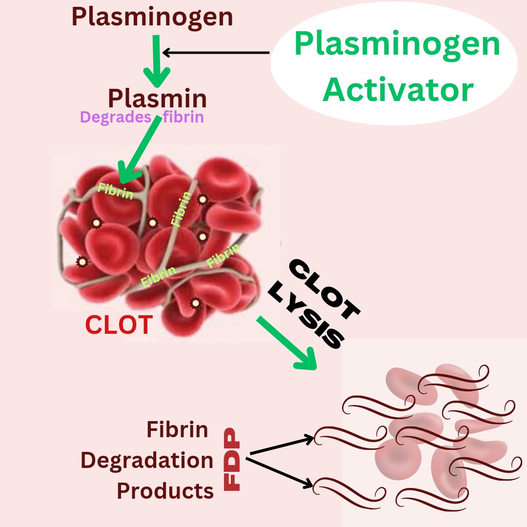 A🧵 on FIBRINOLYTICS First a fact check 👇 INTRAVENOUS THROMBOLYSIS can be successfull if given A ...