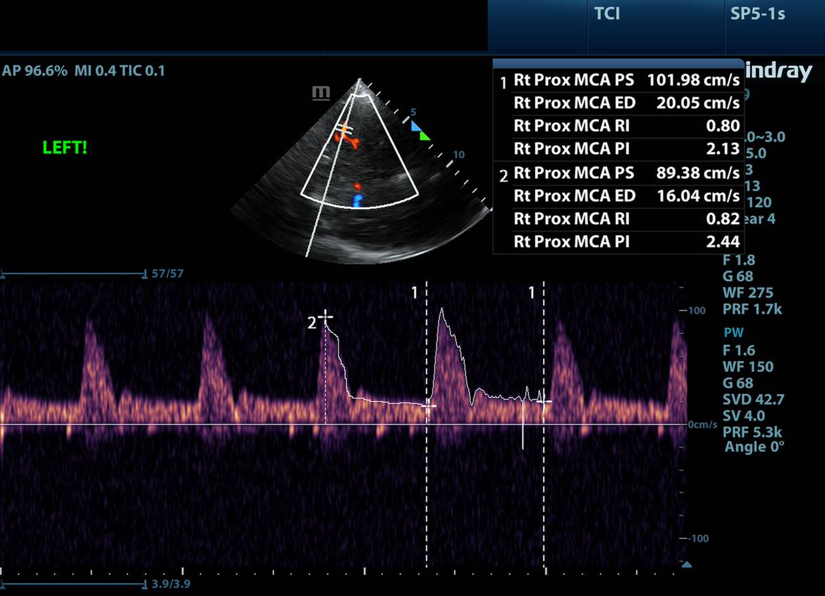Ross Prager's Threads – Thread Reader App