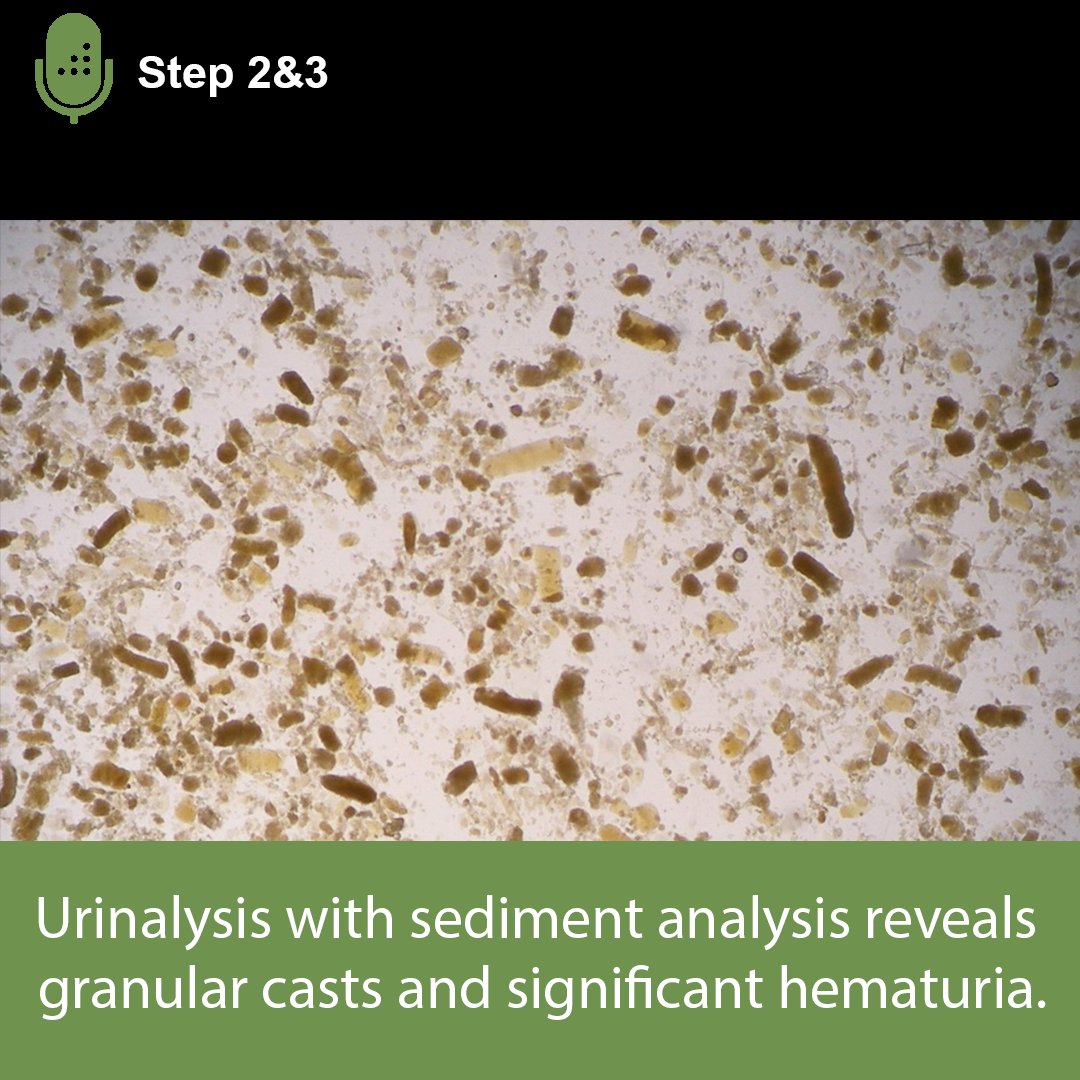 The Nephron Renal Medbullets Step 1