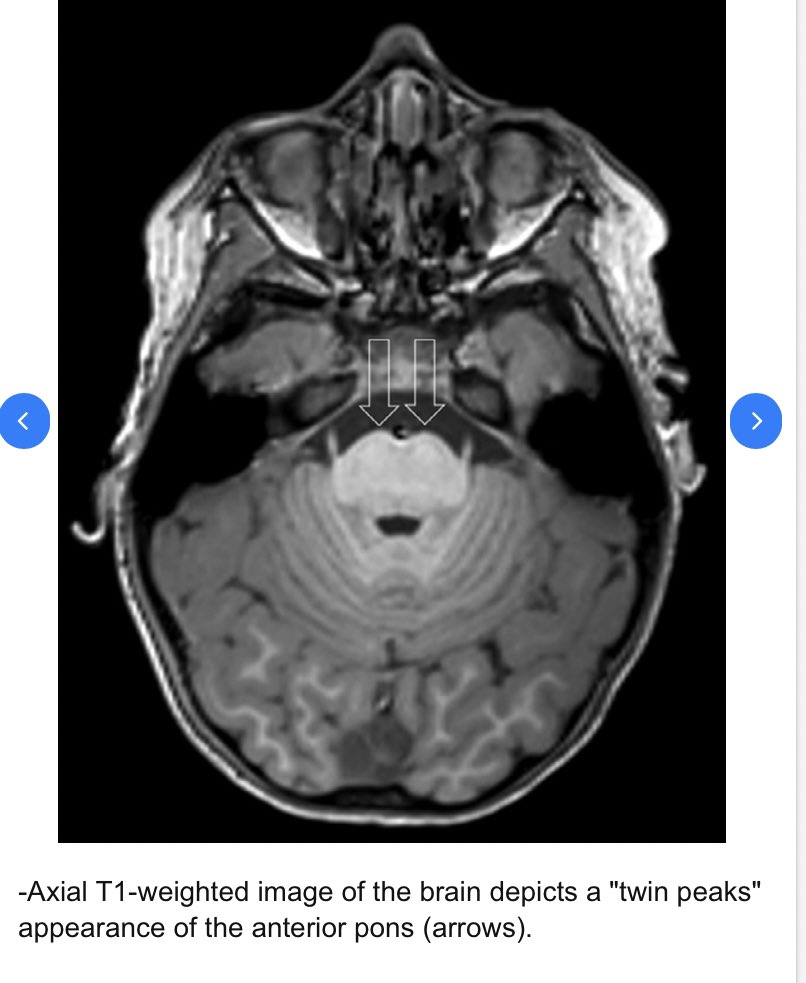 @theNDExperience I’ve been looking into those around Travis Scott ...