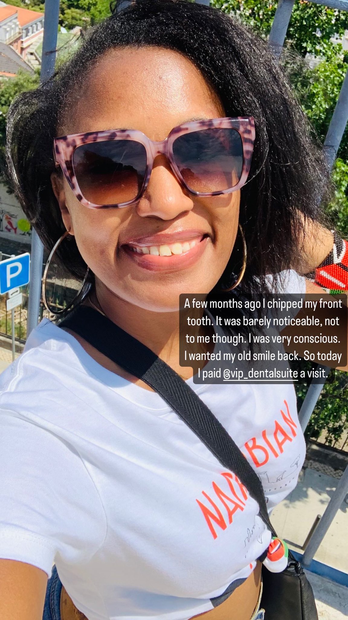 Chipped Front Tooth Woman