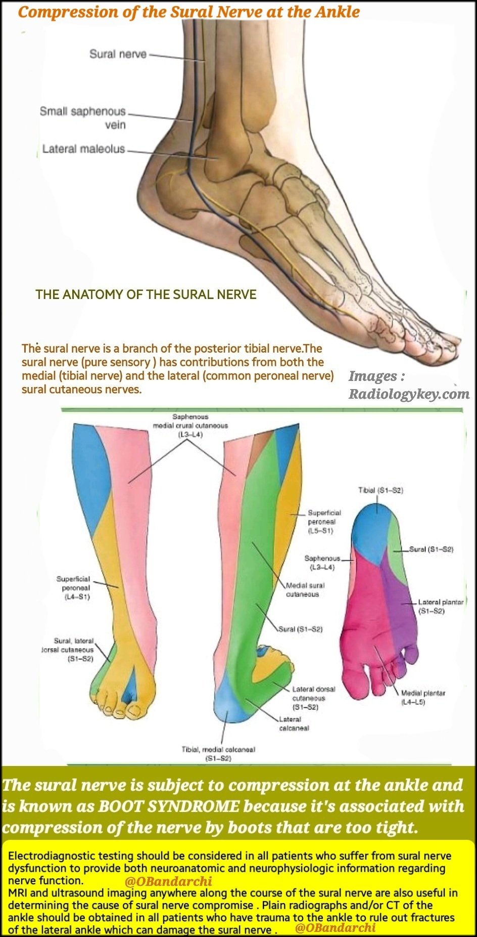 Sural Nerve Tibial Nerve