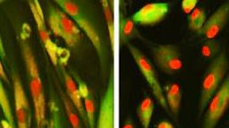 Grateful to share our latest publication: We’ve previously shown age ...