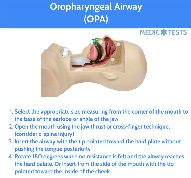 Oropharyngeal Airway