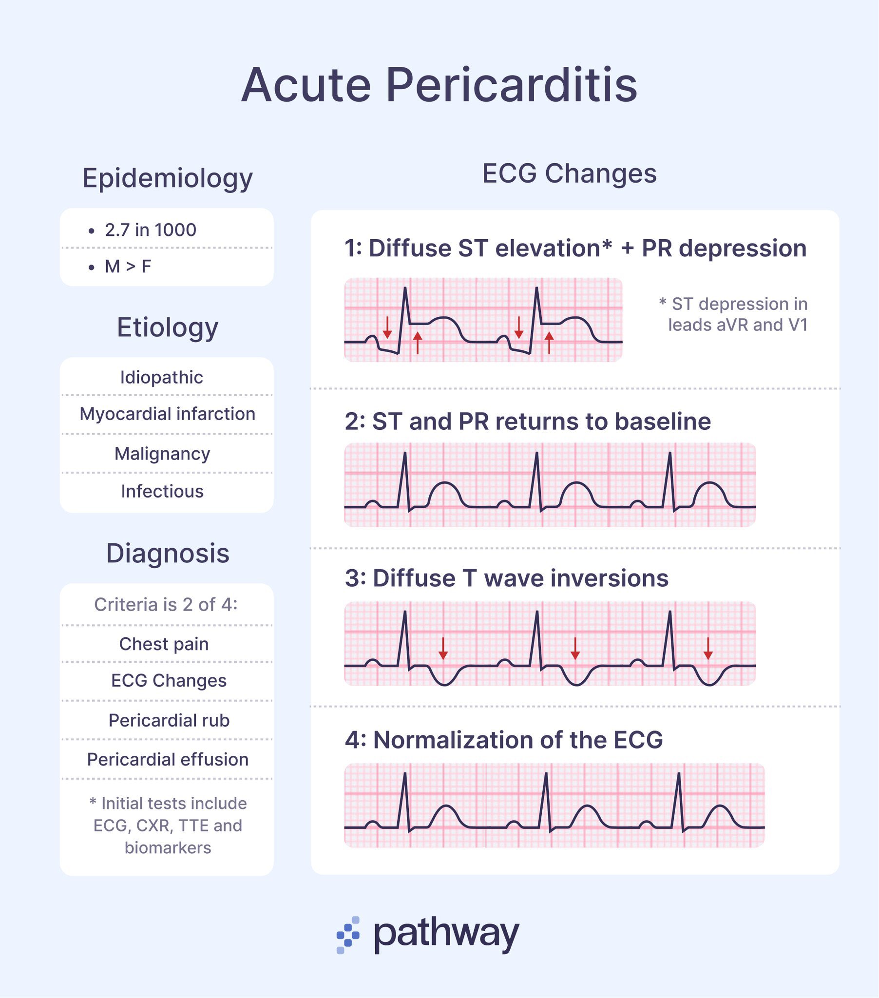 Constrictive Pericarditis Ecg