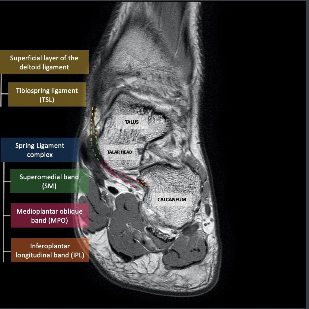 Spring Ligament Parts at Patricia Burns blog