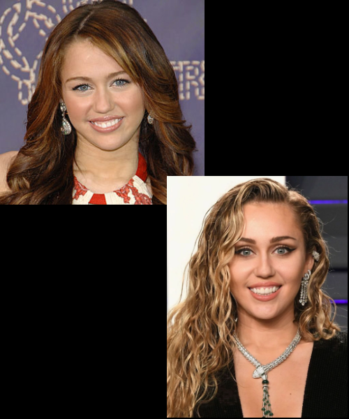Miley Cyrus Nose Job Before And After