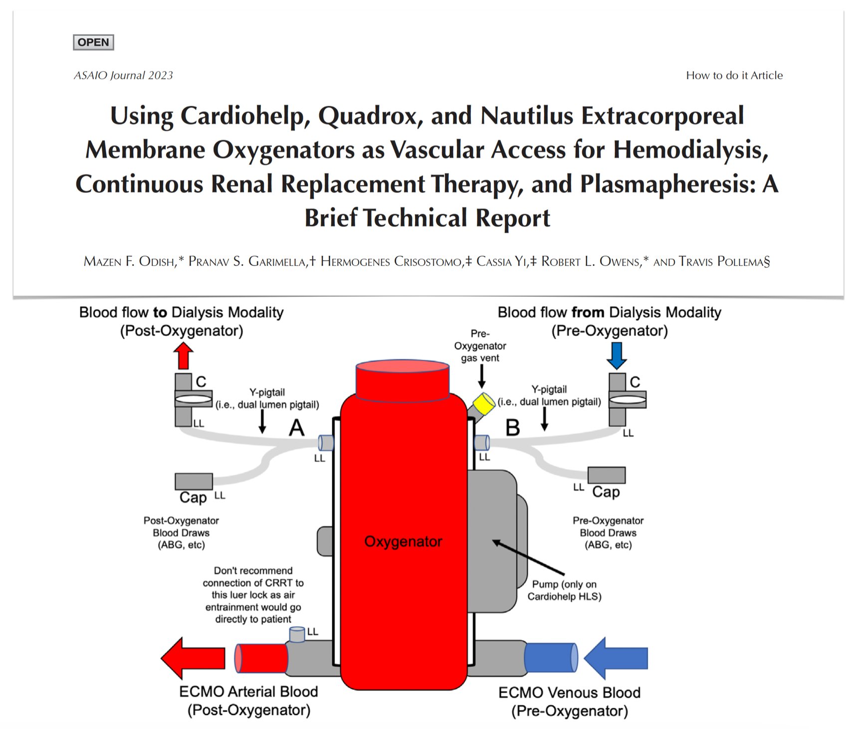Ecmo Circuit Diagram