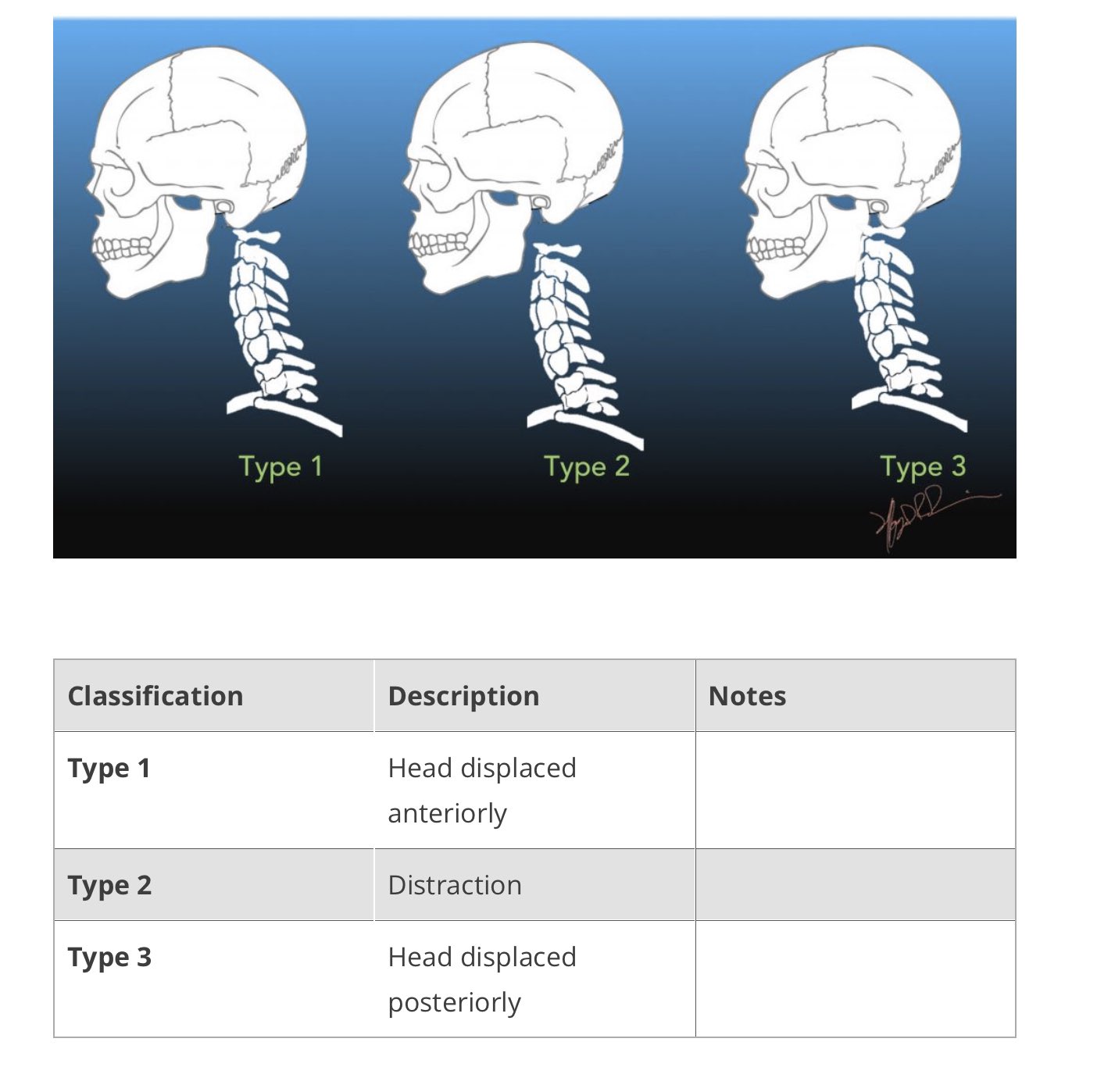 Atlanto Occipital Dislocation Radiology Stabilizing The Unstable: