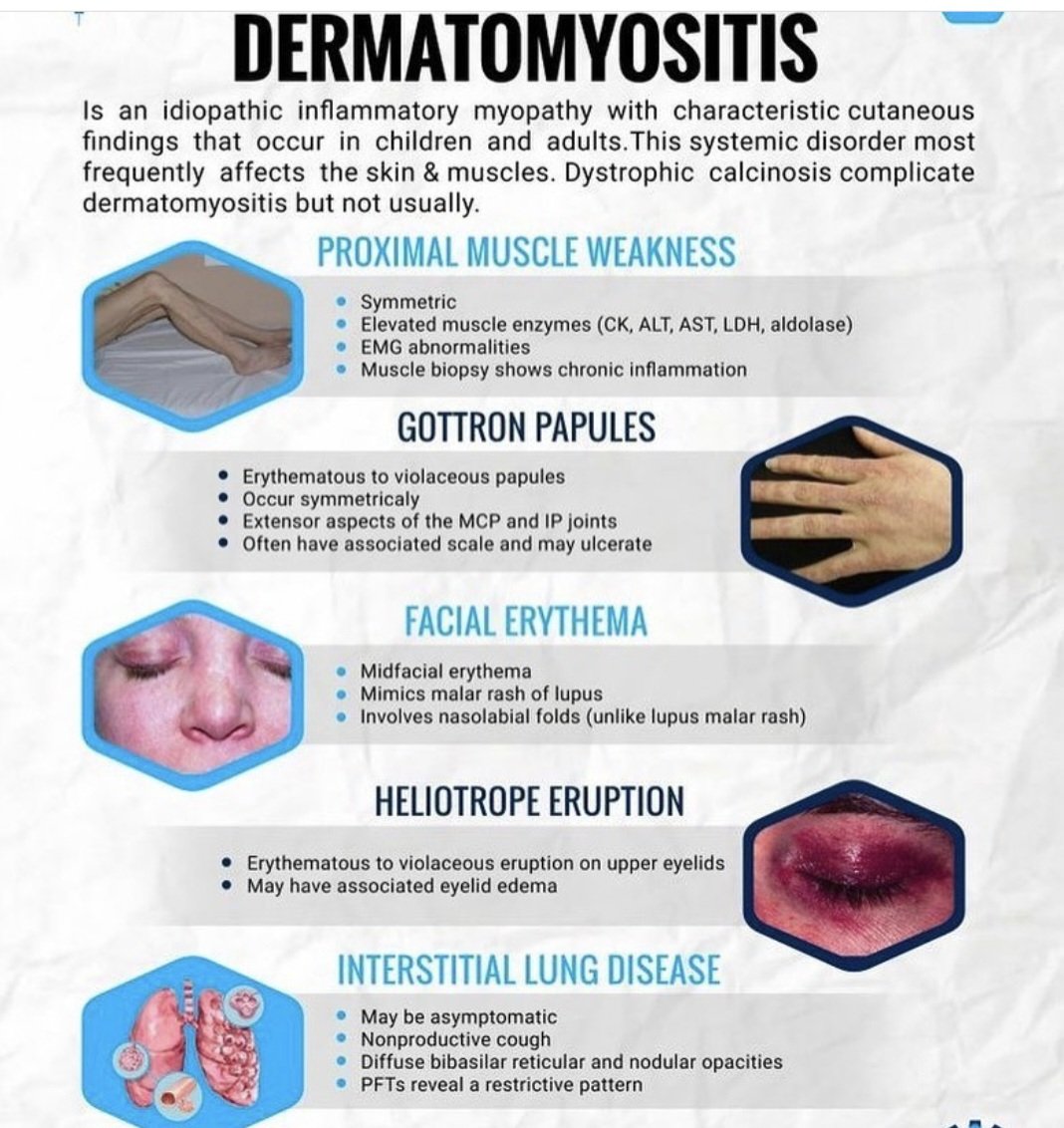 Dermatomyositis