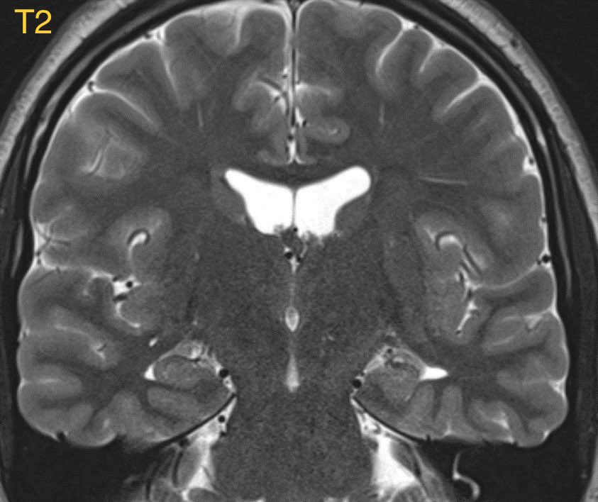 Thread by @daniel_gewolb on Thread Reader App – Thread Reader App