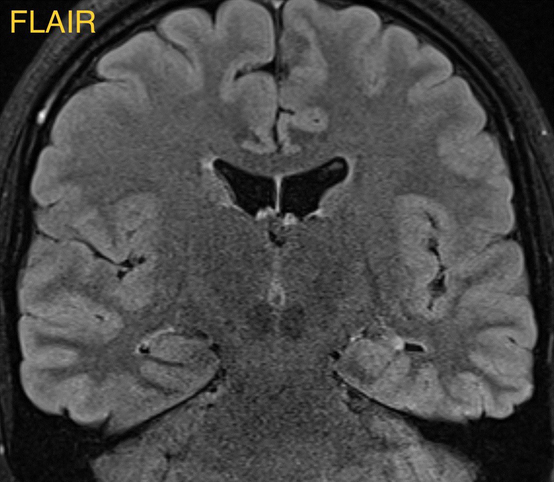 Thread by @daniel_gewolb on Thread Reader App – Thread Reader App