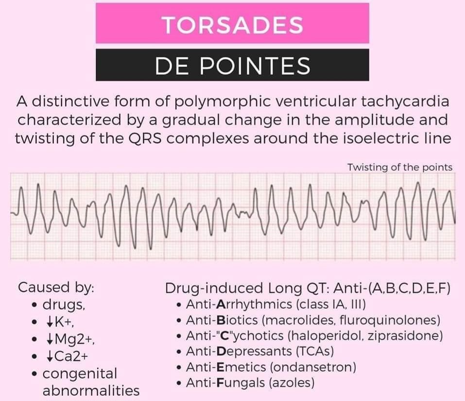 Torsades De Pointes Vs Ventricular Fibrillation