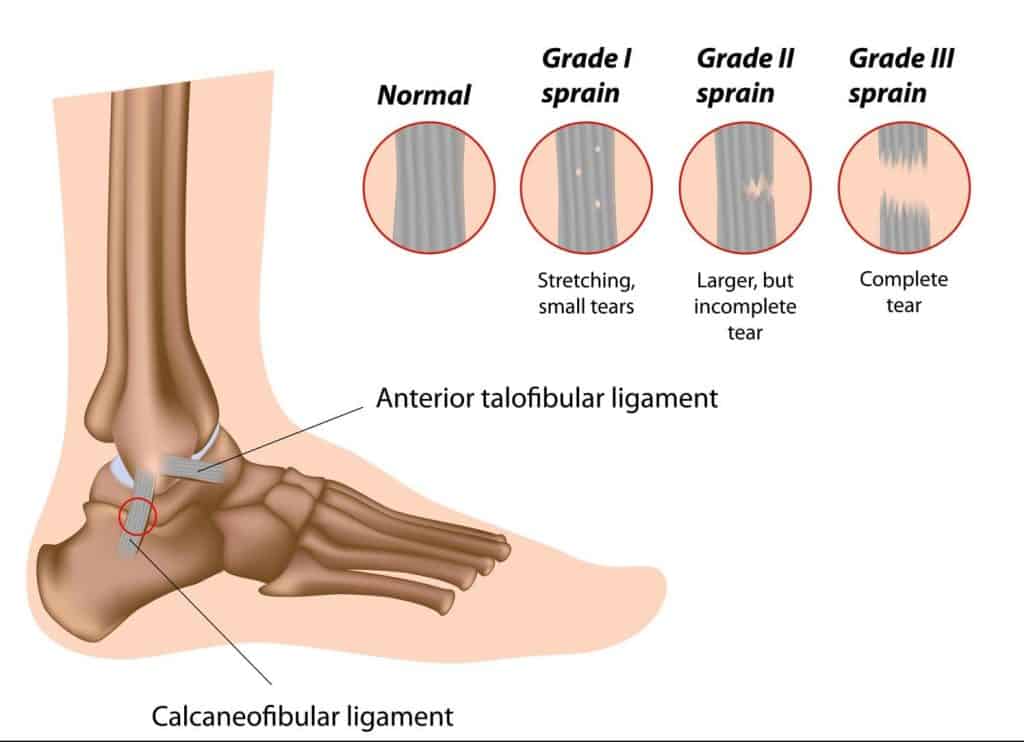 MillsRx On Twitter WashMystics Elena Initially Rolled Her Ankle On millsrx-on-twitter-washmystics-elena-initially-rolled-her-ankle-on