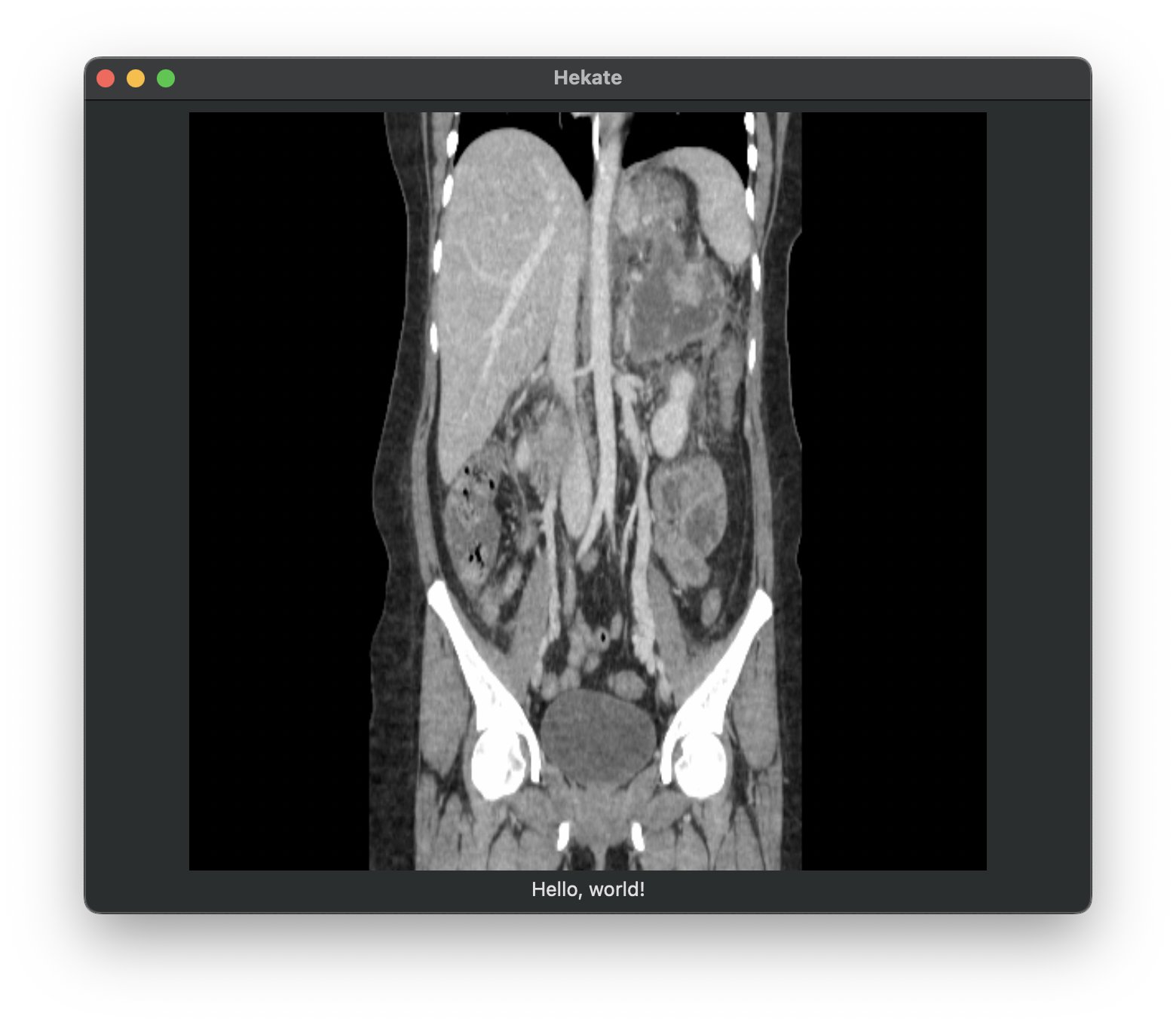 Cyril Zakka Md On Twitter Been Playing Around With Making My Own