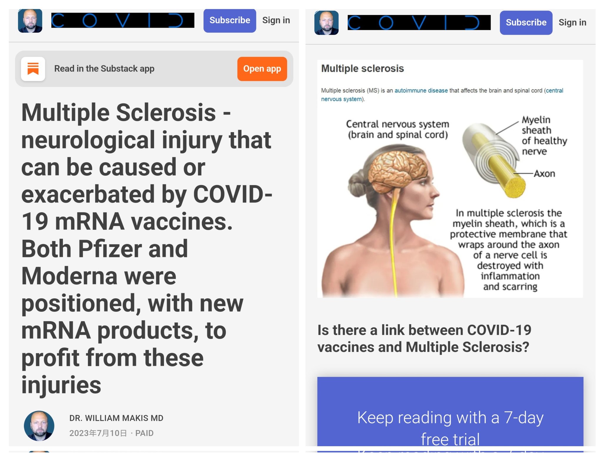 Kiran Harbourne on Twitter: "WILLIAM MAKIS 醫生，醫學博士： 多發性硬化症 - 神經傷害可以由新冠 mRNA疫苗造成或加劇，輝瑞和莫德納兩家藥廠都曾 ...