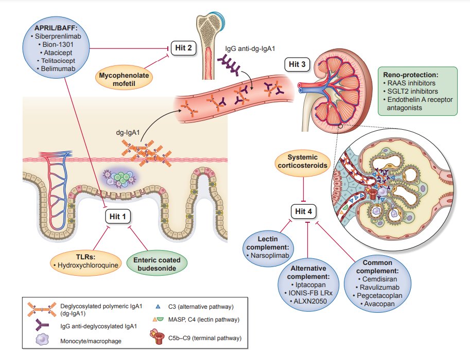 NDT on Twitter: "📢NEW Treatment Standard: IgA nephropathy in adults 📸The 4 pathogenic hits of ...