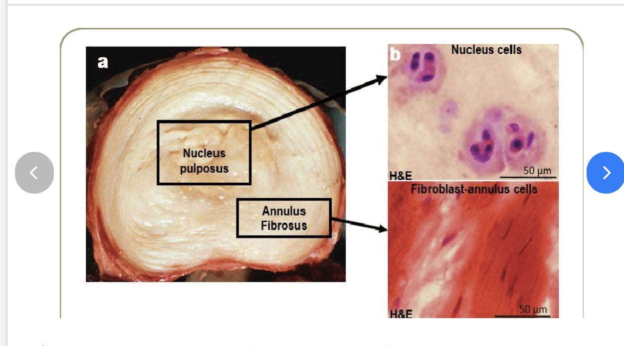 Nucleus Pulposus Histology
