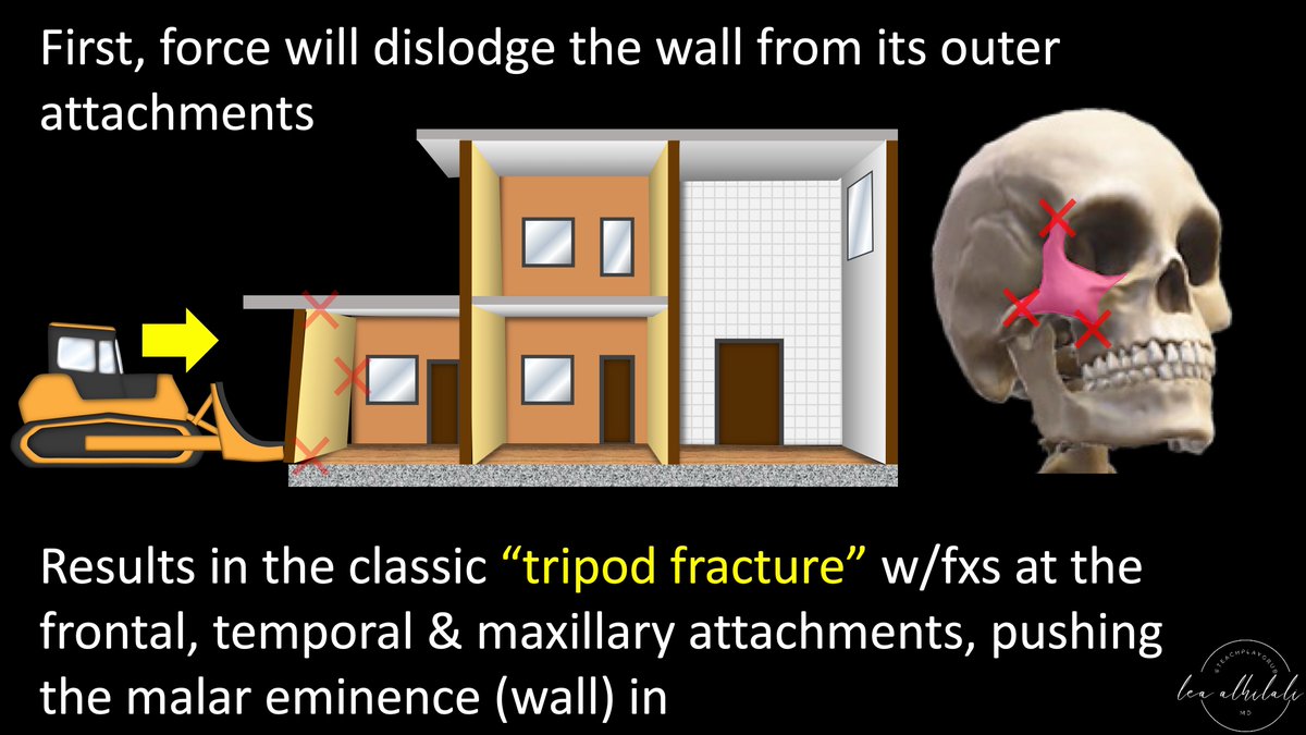 1/Facial fractures get a little cheeky! If you are still calling those ...