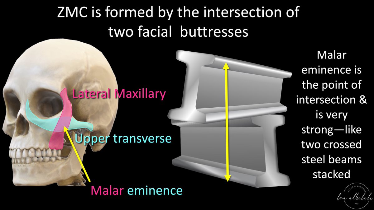 1/Facial fractures get a little cheeky! If you are still calling those ...
