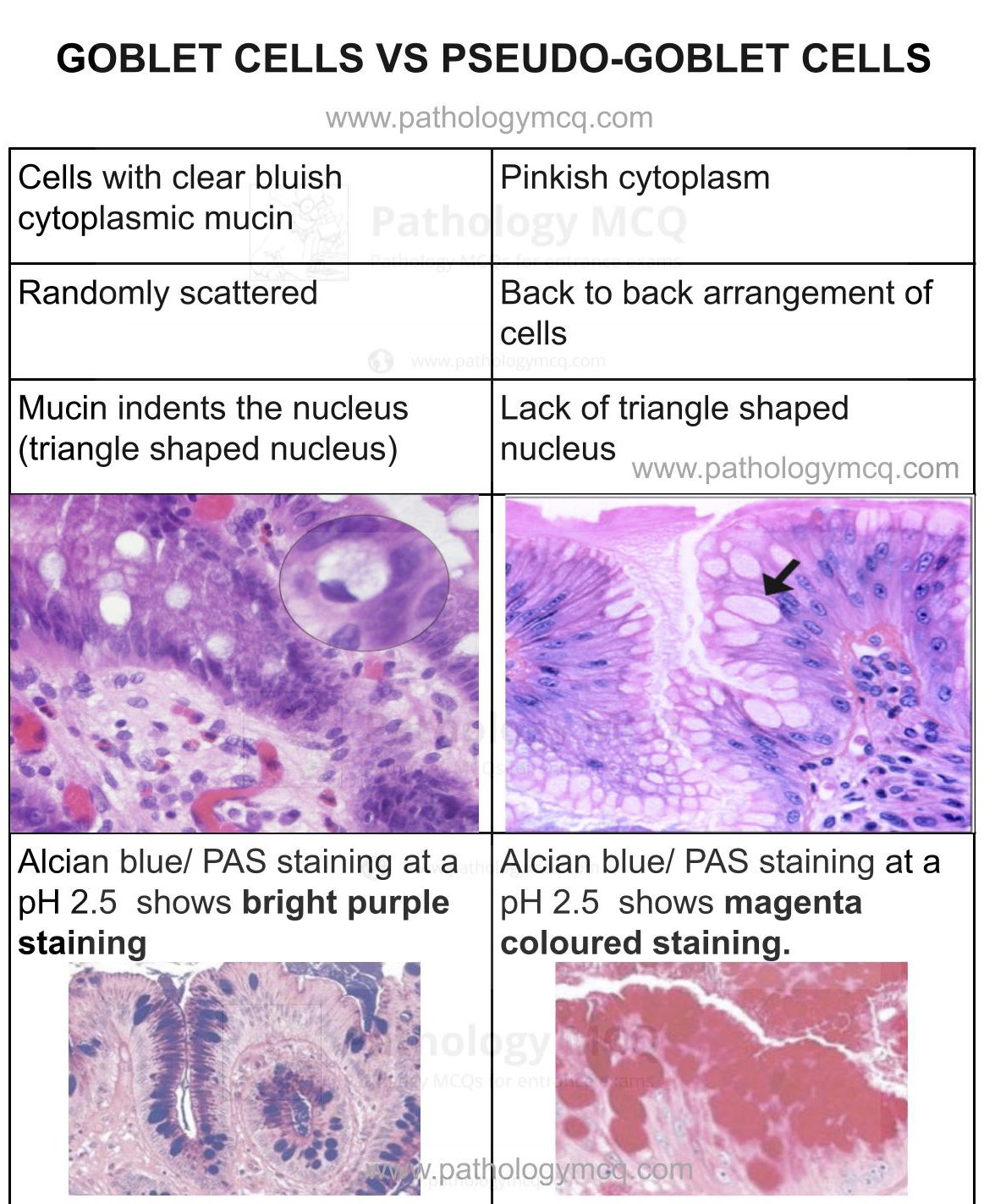 Clara Cells Histology