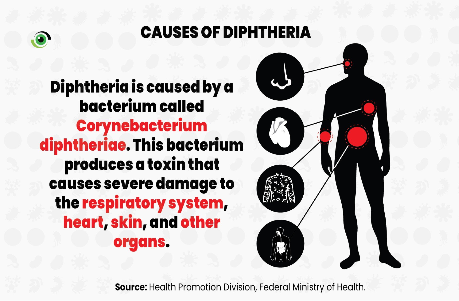 Diphtheria Causes
