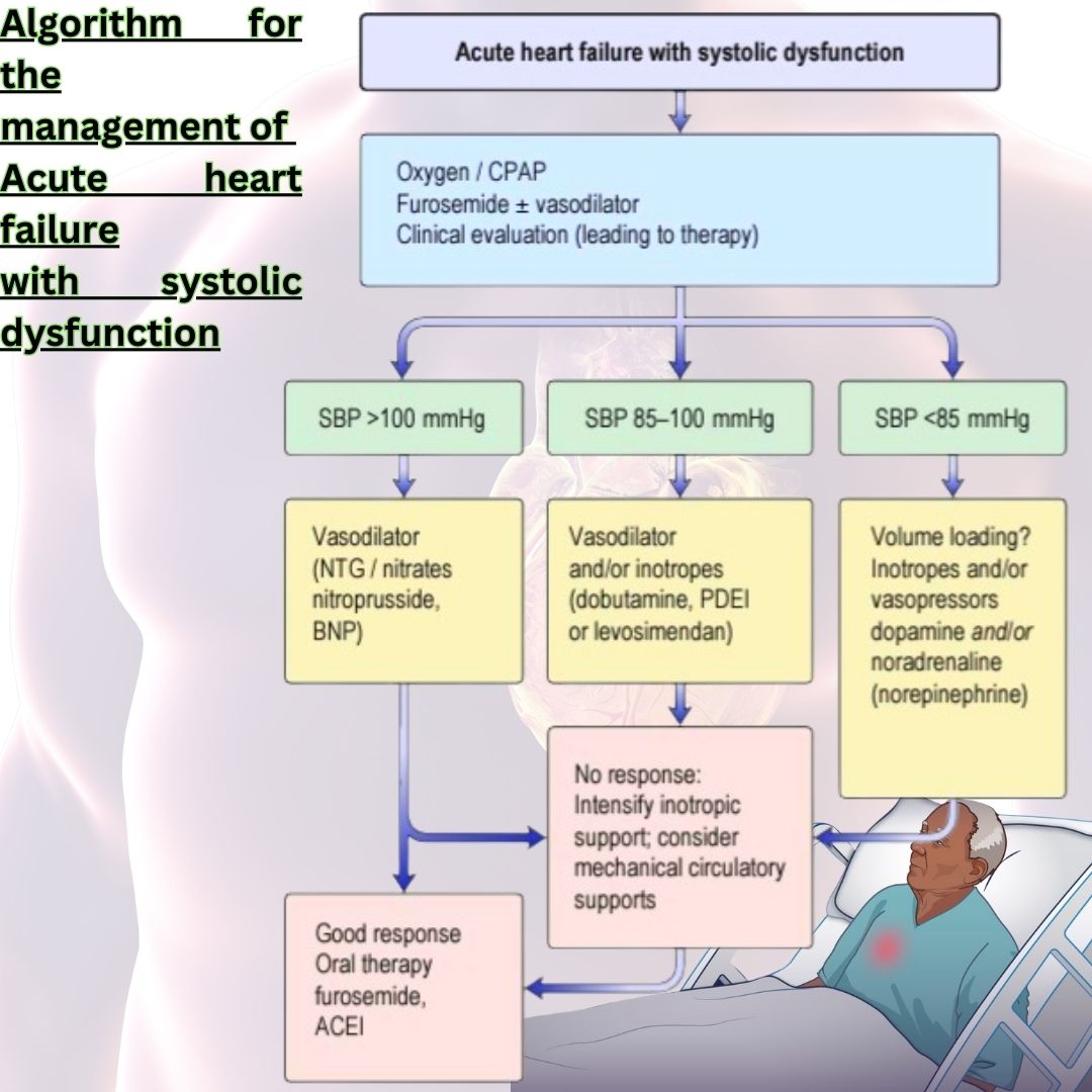 NTE®️N🅰️L Ⓜ️edℹ©️ℹne on Twitter: "🚨Algorithm for the management of Acute heart failure with ...