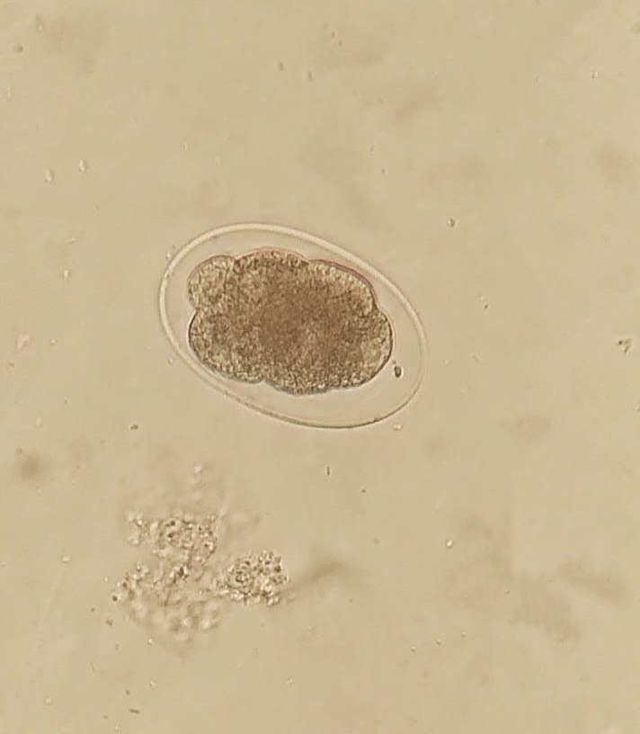 Hookworm Egg