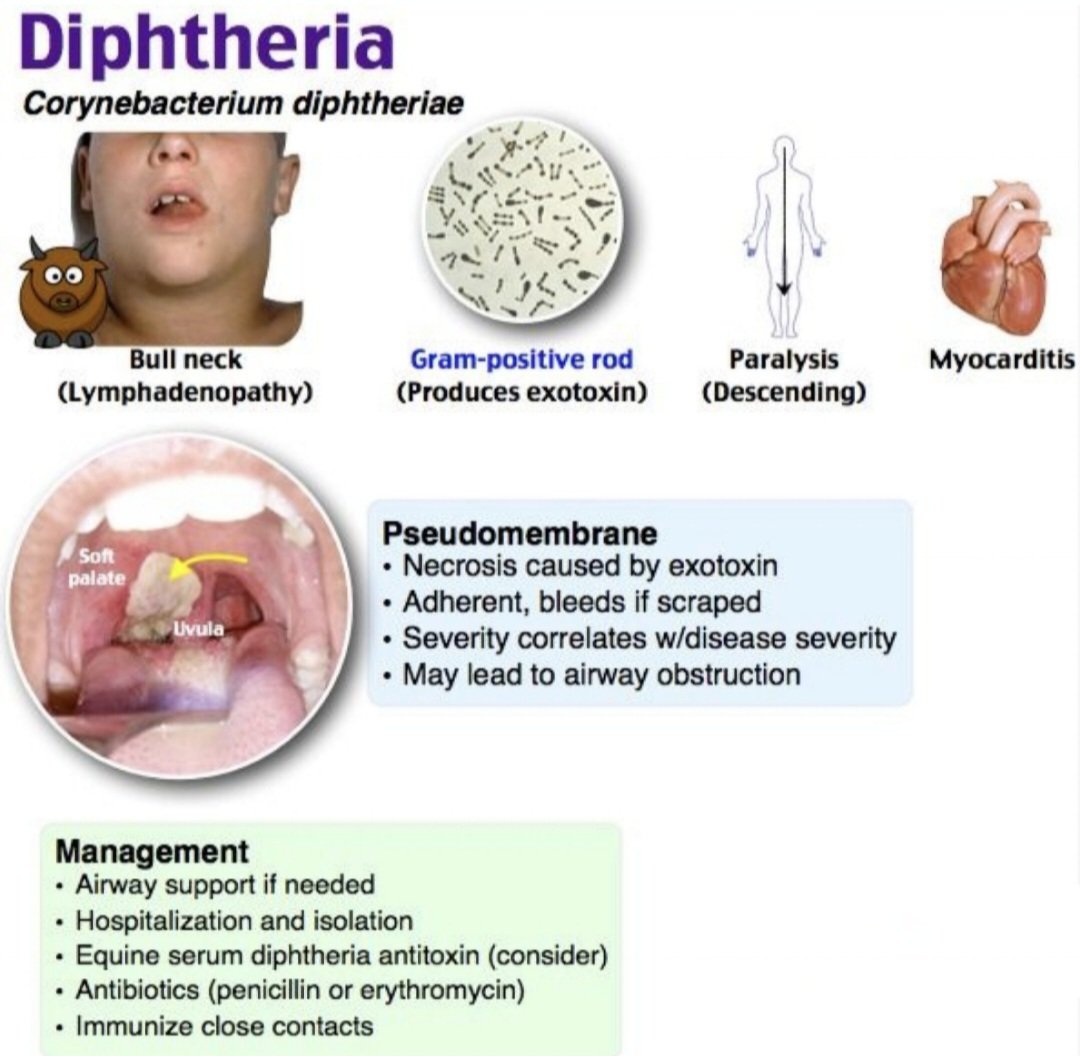 Diphtheria Causes