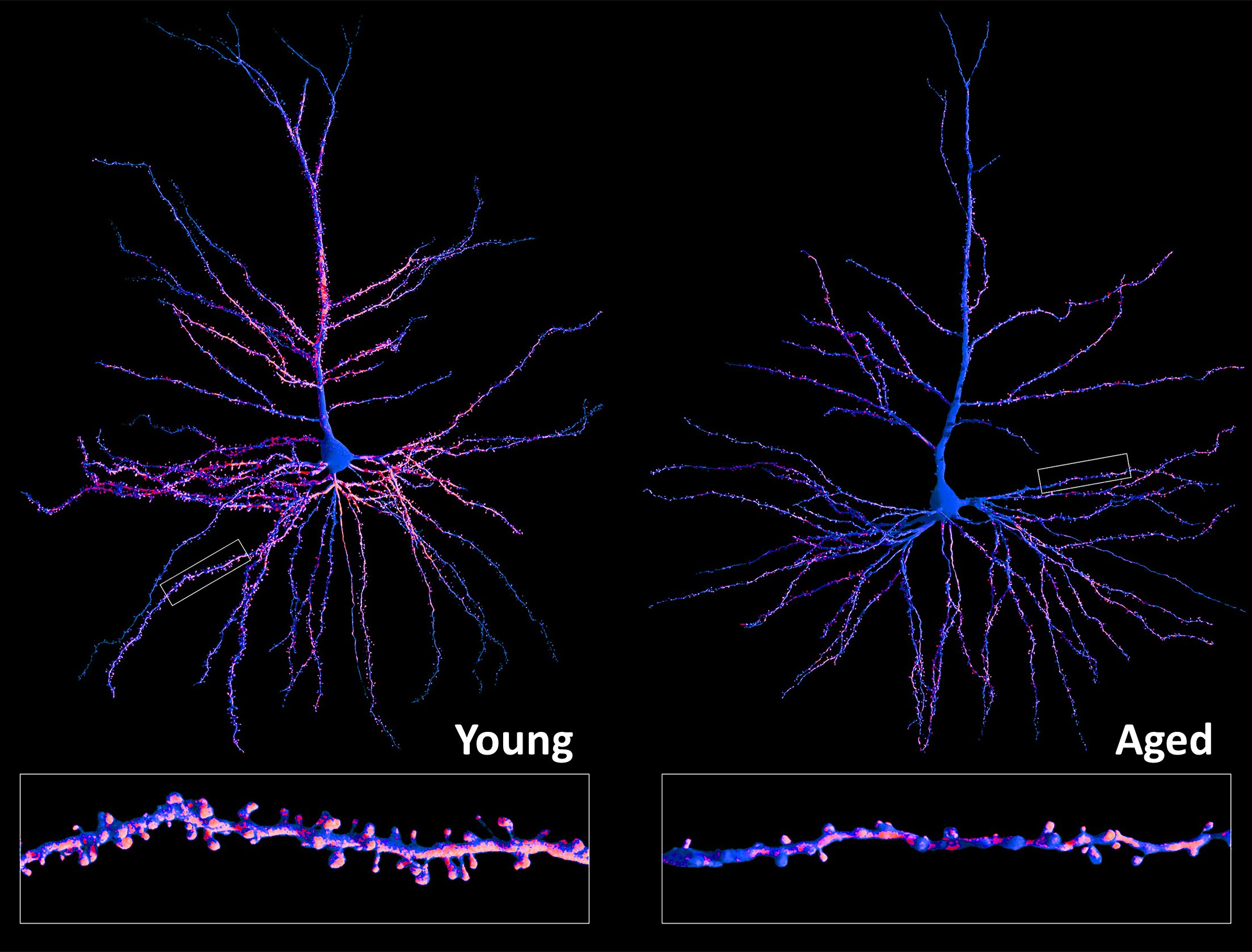 Danielle Beckman on Twitter: "Happy #MicroscopyMonday with more #Cajal!🔬🤓 Using the Golgi ...