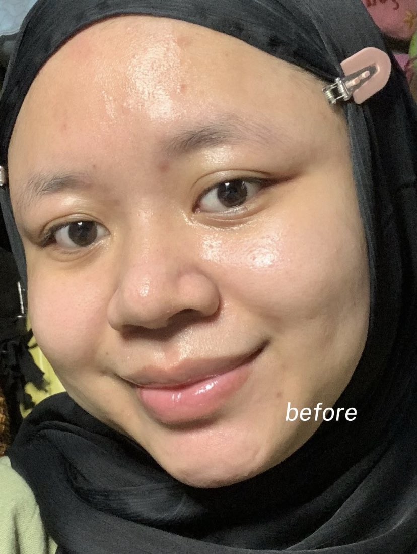 Anin on Twitter: Anin on Twitter:
