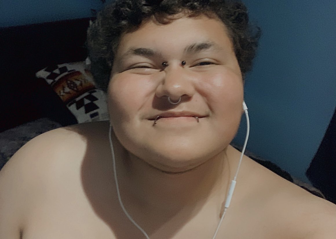 val/sam ! wwdits spoils🦇 on Twitter: "we are officially one week post op !! i can take my strips ...