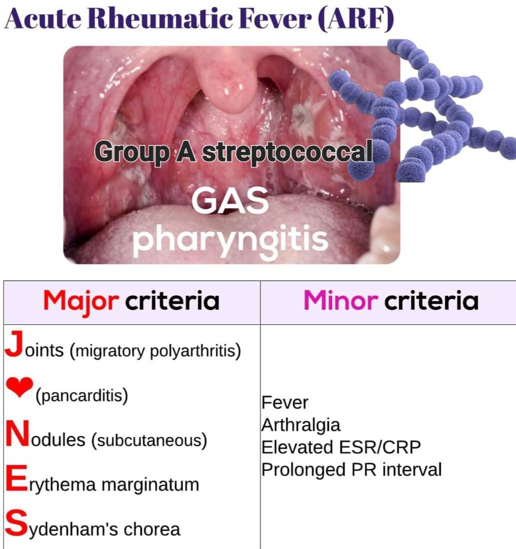 Subcutaneous Nodules Rheumatic Fever