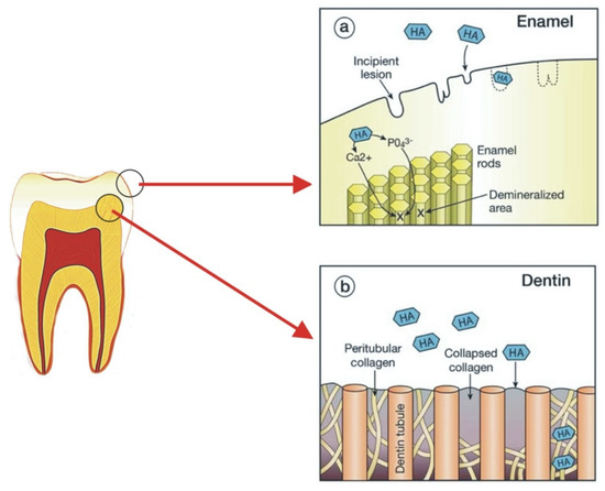 You've probably seen many mention that NOBS helps with tooth ...