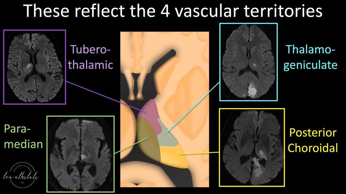 1/Correlate clinically! It’s harder than you think in the THALAMUS ...