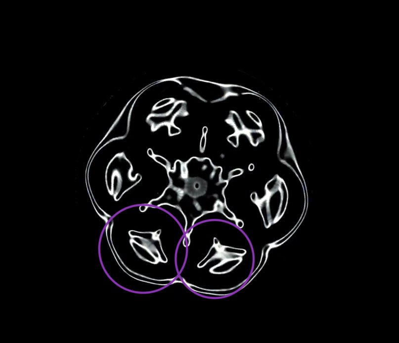 As Archie says - “Your body and all the matter you know as reality is ...