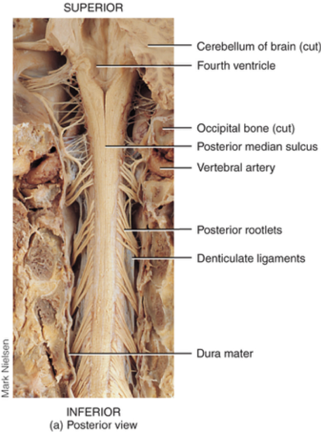 Spinal Nerve Cadaver Spinal Cord & Meninges (Photos) Gross Anatomy