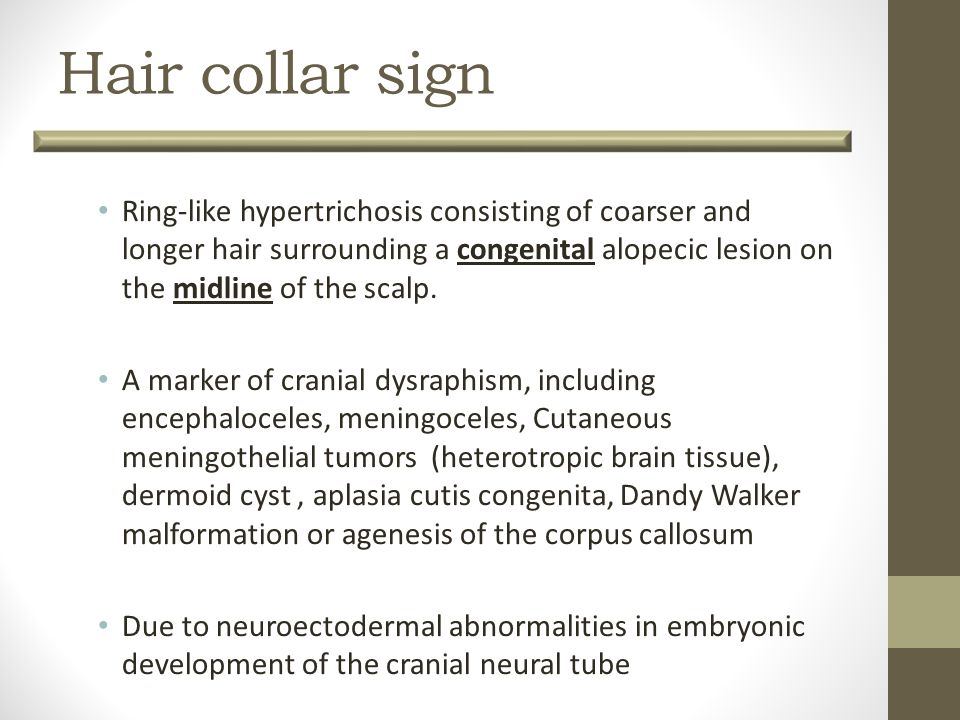 What are the signs here in these images.. Importance? - Thread from ...
