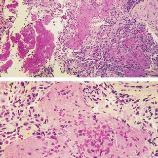 😢Lost a dear patient early in training to this severe complication😢 ...