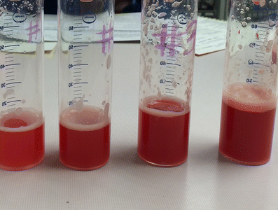 😢Lost a dear patient early in training to this severe complication😢 ...