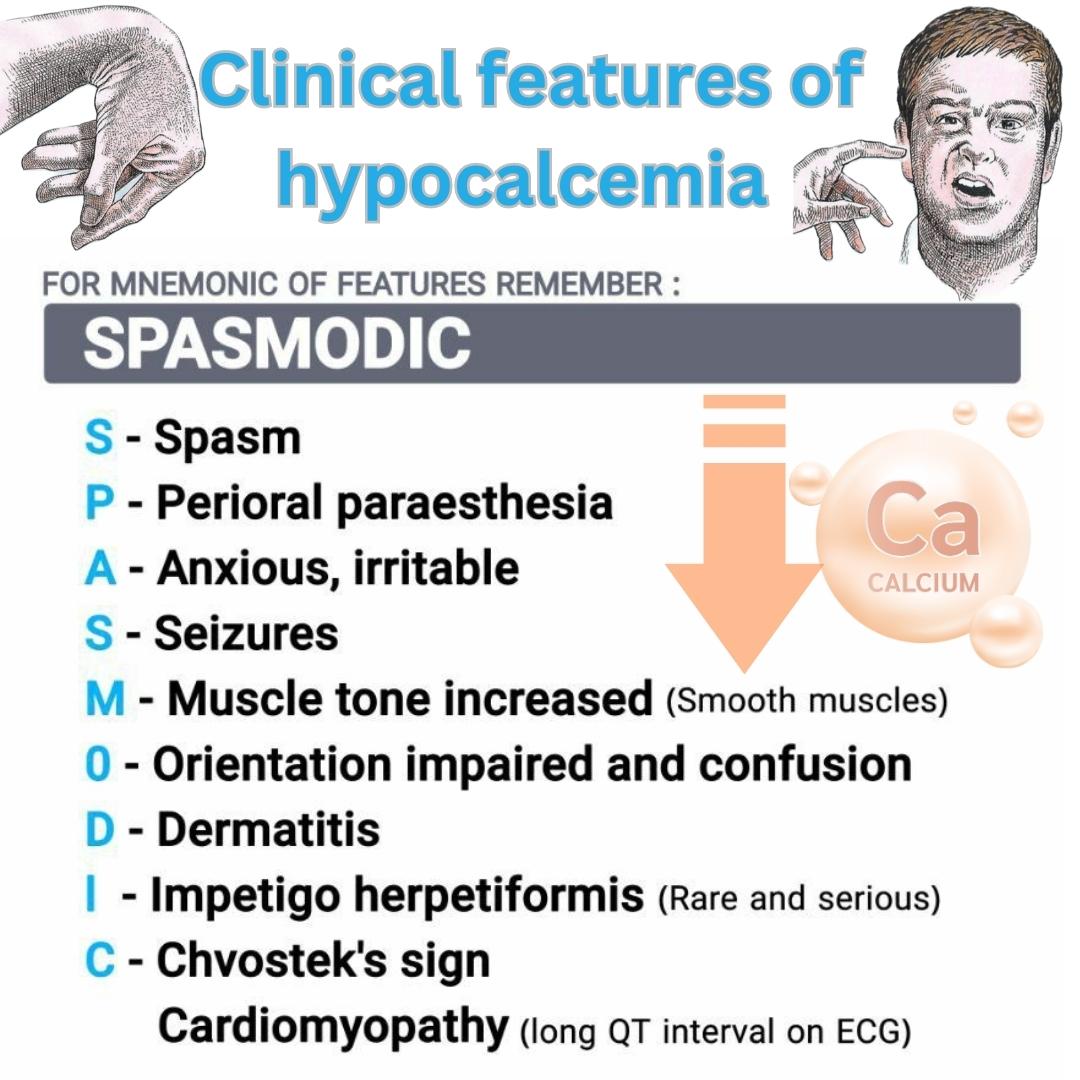 Hypocalcemia Mnemonic