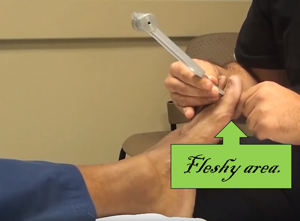 🧷🔥The Sensory Exam.🧊👈 Some neurologists just skip it. Compared to other ...